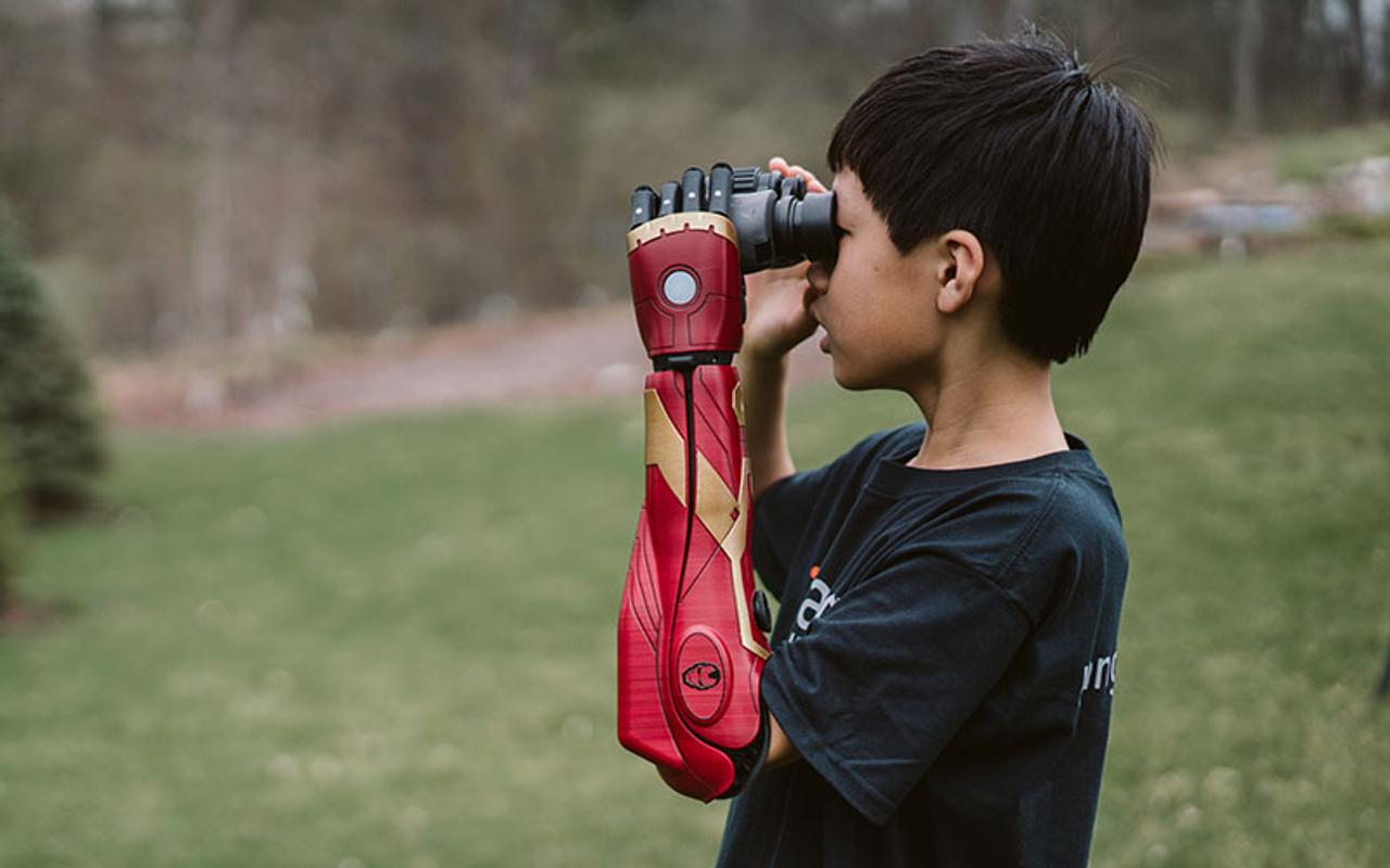 Open Bionics Pursues “Heroic” Robotics Mission